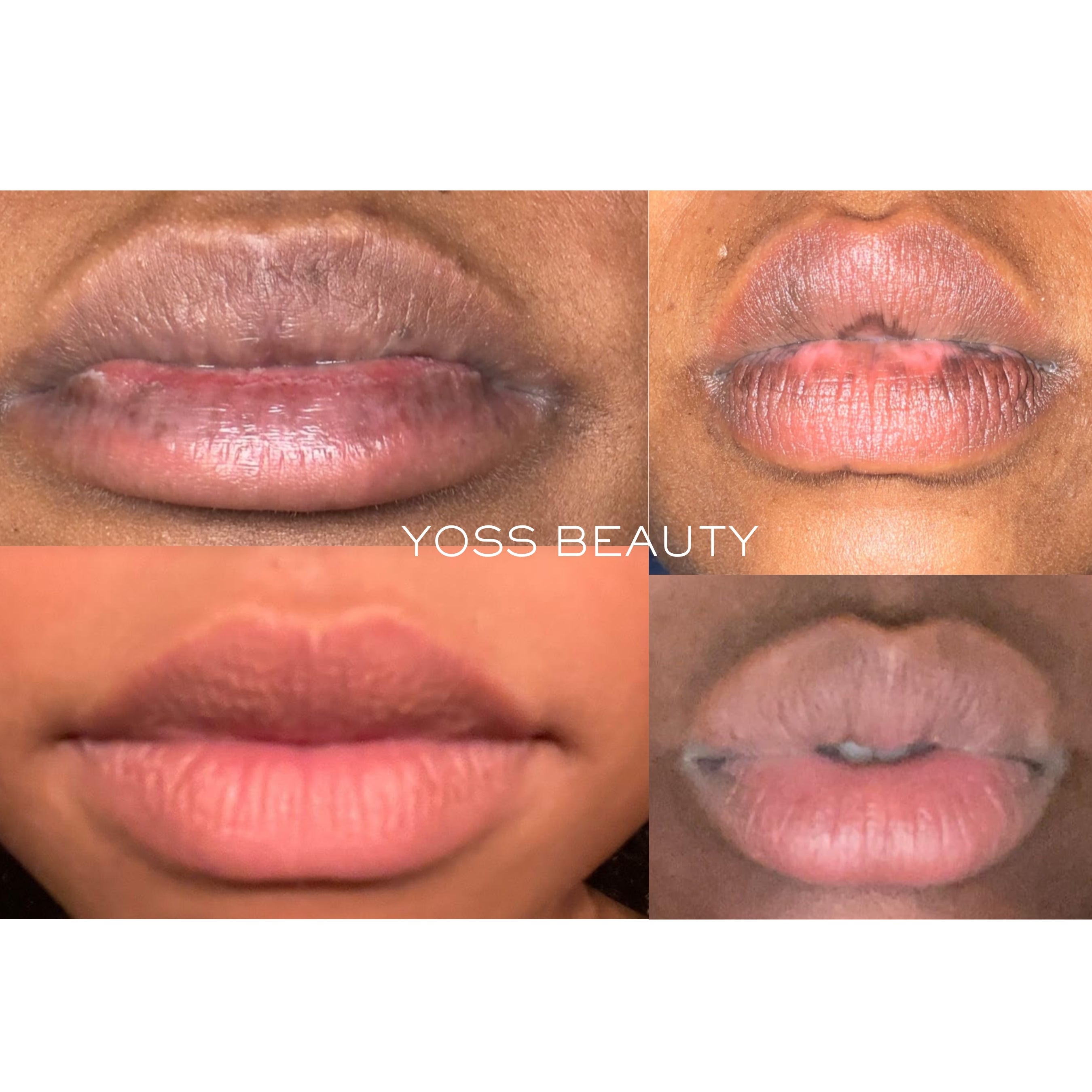 Lip Brightening Cream, Pink Lips Cream, Glow Lip Cream 30g – Yoss Beauty